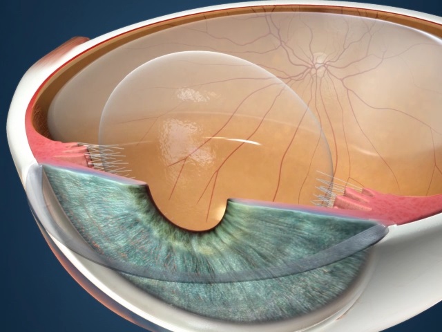 Learn About the Eye Lens | Retina Doctor Melbourne
