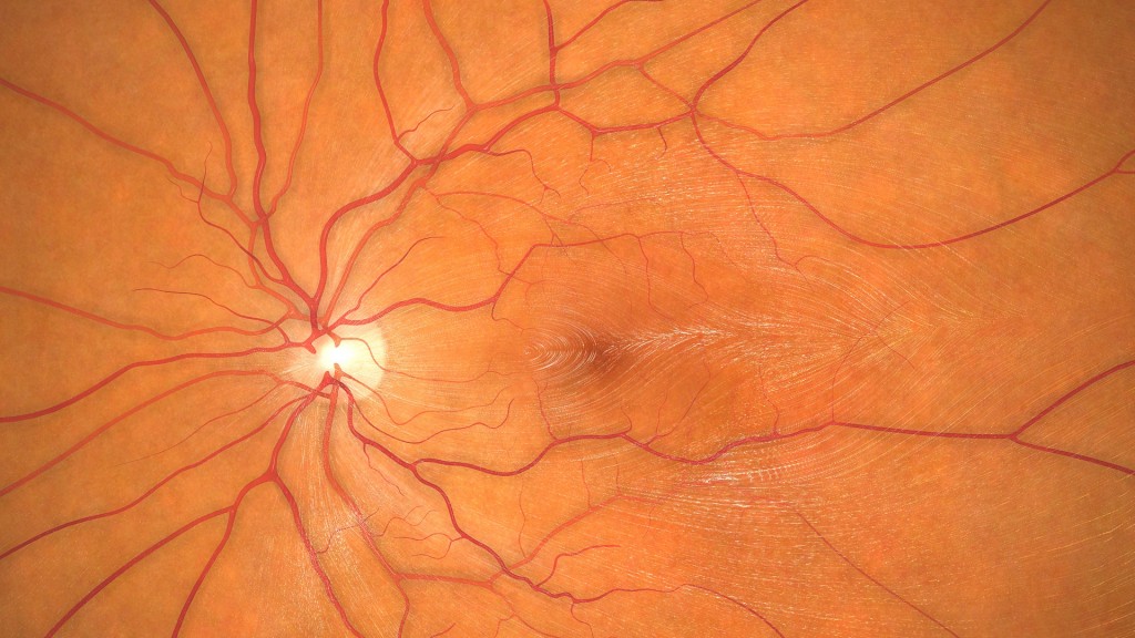 Retina3_EYE_ANATOMY_0074_ana_eye_post-view - Retina Doctor