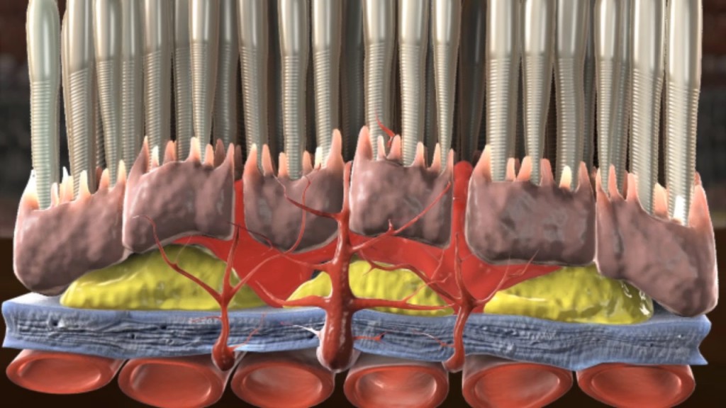 AMD CNV cross section - Retina Doctor