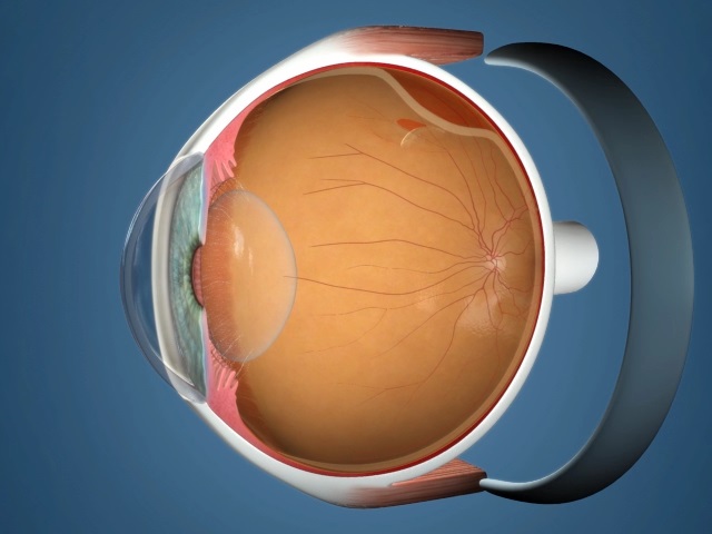 Scleral Buckle 3D - Retina Doctor
